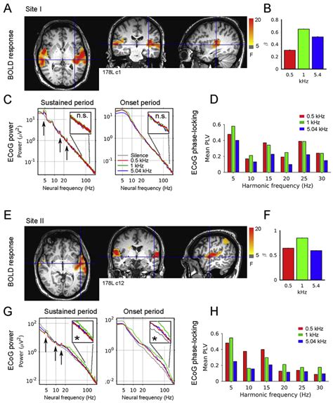 Neural Phase Locking Predicts Bold Response In Human Auditory Cortex Pmc
