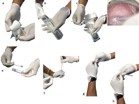 Using HPV Tests For Cervical Cancer Screening And Managing HPV Positive Women A Practical