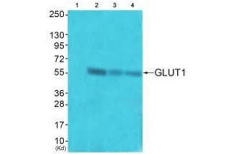 Anti Glut1 Antibody A37687