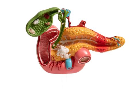 Type 3c Diabetes In Dubai Causes Symptoms And Treatment