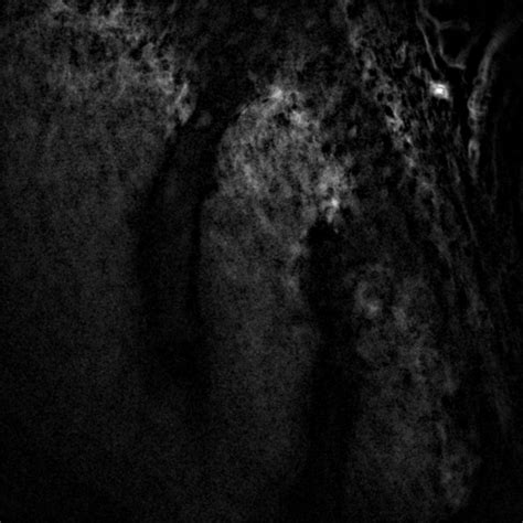 Median Filter Example