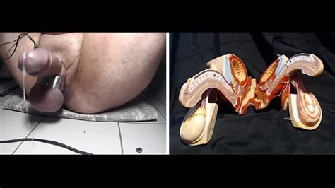 Male Genital System Xxx Mobile Porno Videos And Movies Iporntvnet