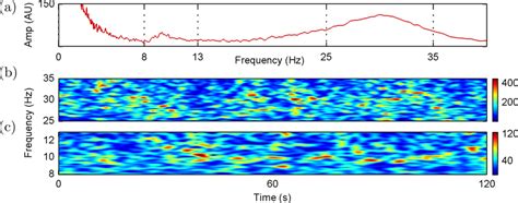 Color Online Wavelet Transform Analysis Of The Eeg Signal From A