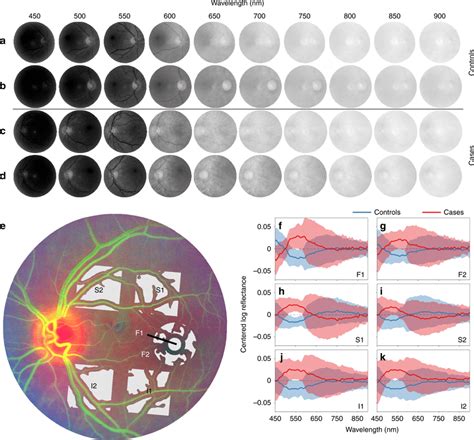 Spectral Variation Between Eyes Precludes Discrimination Between Cases