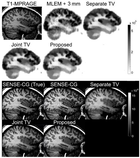 The Same As In Fig 8 But With An Mr Acceleration Of 3 In The Phase