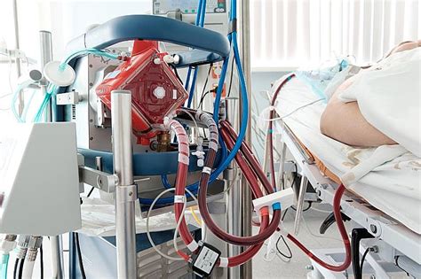 Prone Versus Supine Positioning In Ards No Impact On Ecmo Weaning Time