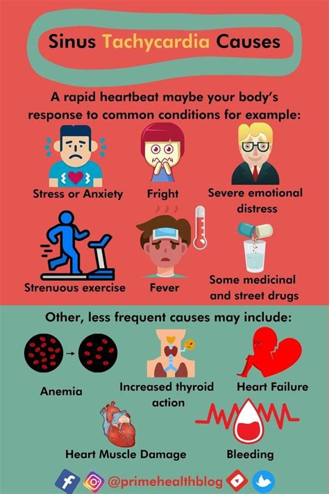 Sinus Tachycardia Symptoms
