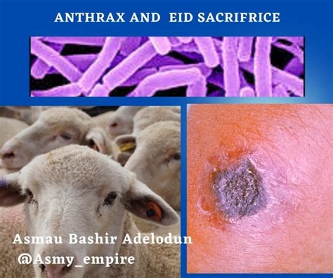 Asmy Empire Healthtalk Awareness Asmau Bashir Adelodun