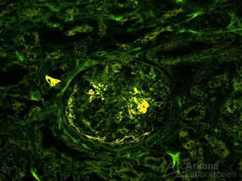 Fluorescence Microscopy Teaching Points Arkana Laboratories
