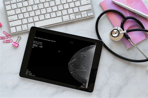 How Ai Is Advancing Mammographic Density Based Breast Cancer Risk