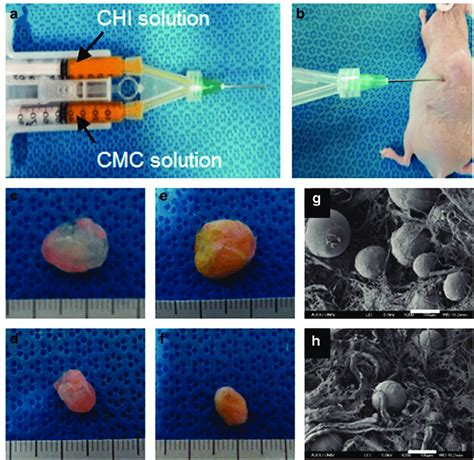 Pictures Of A Dual Injection Formulations B Subcutaneous Injection