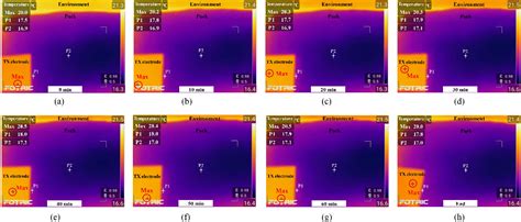 figure 1 from an investigation of implantable capacitive coupling intra