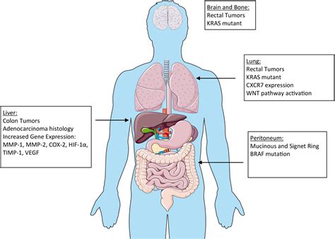 Surgical Treatment Of Metastatic Colorectal Cancer Surgical Oncology Clinics