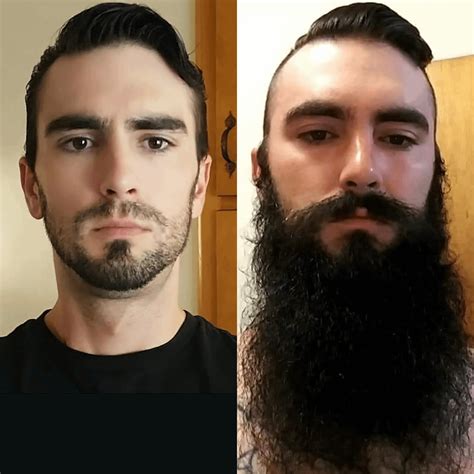 My Beard Advice Let It Grow Rbeardadvice