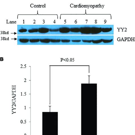 increased levels of yy2 in failing human hearts a western blot