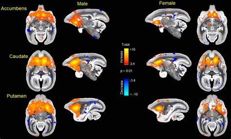 Sex Differences In Cognitive Flexibility And Resting Brain Networks In