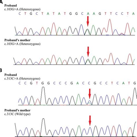 A Sequence Chromatogram And Alignment To The Reference Sequence Showing Download Scientific