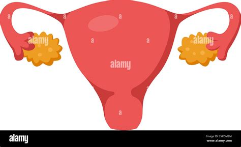 Medical Illustration Representing Female Reproductive Organs Including