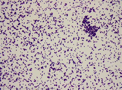 Staphylococcus Epidermidis