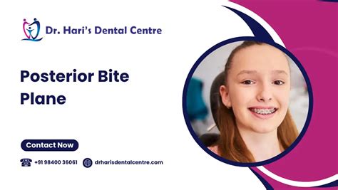 Posterior Bite Plane 4 Powerful Uses And Benefits Guide