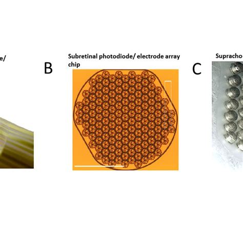 Examples Of Electrically Stimulating Suprachoroidal And Subretinal Download Scientific Diagram