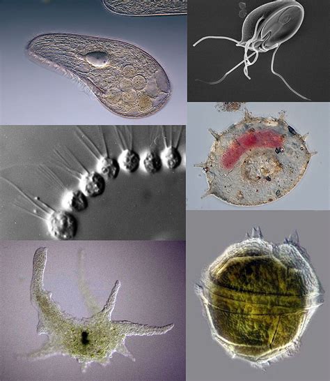 Protozoa Wikipedia