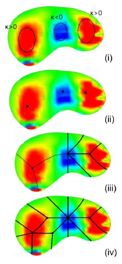Position Of The Singularities I Find Positive And Negative Extremes
