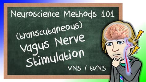 miles wischnewski on linkedin vagus nerve stimulation explained vns