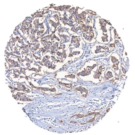 Human Tissue Microarray Life Science Company Mymab Biologics