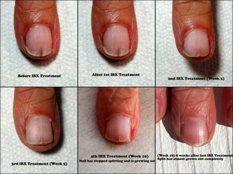 Repair Your Nails With Ibx Treatment Rambling Rose