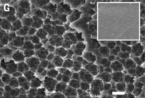 Ideonella Sakaiensis Alchetron The Free Social Encyclopedia