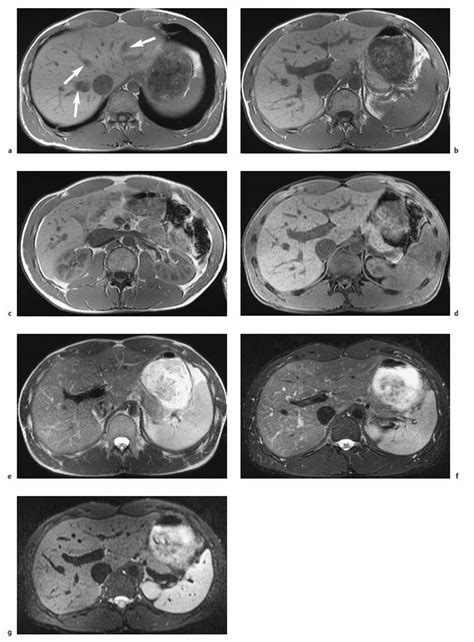 The Liver Radiology Key