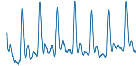Github Jovenstrikerremovingppgmotionartifacts Multiprocessing Code