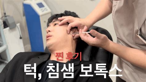 턱 귀밑샘 턱밑샘 보톡스 직접 맞았습니다 남자필수관리 보톡스 턱보톡스 침샘보톡스 Youtube