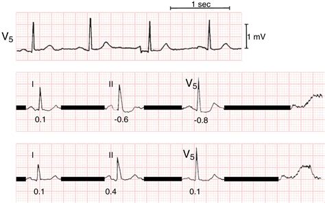 cardiovascular monitoring clinical tree