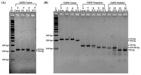 Prevalence Of G6pd Deficiency And G6pd Variants Amongst The Southern