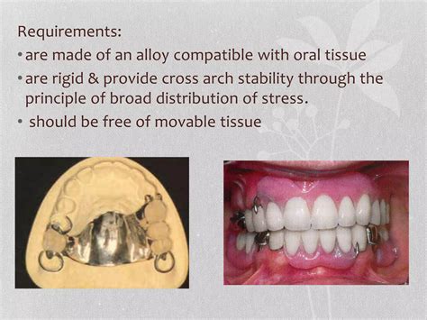 Removable Partial Denture PPTX