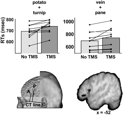Figure 1 From Dissociating Linguistic Processes In The Left Inferior Frontal Cortex With