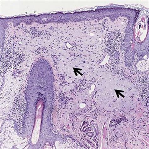 Variations Of Uvb Blue Line And Uva Red Line Irradiances Along A