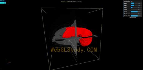 Threejs【webgl】载入3d医疗影像数据nrrd模型源码【含ct的3d骨头模型】 Webgl学习网