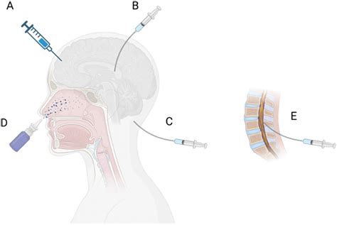 Intrathecal Injection Strategies For Enhanced Gene Delivery To The