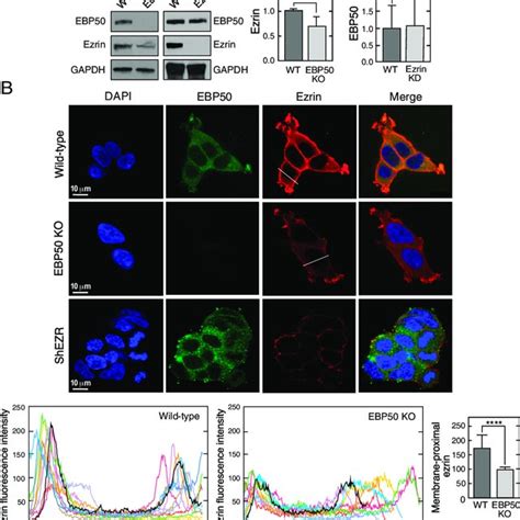 Ebp50 Regulates Ezrin Expression And Localization A Influence Of