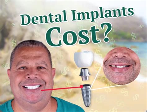 How Much Does A Tooth Implant Cost In Puerto Vallarta Mexico