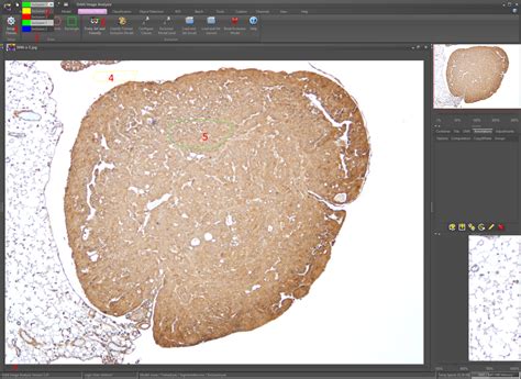 Exclusion Models Orbit