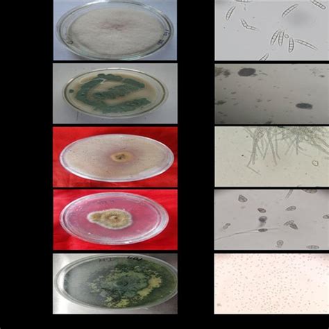 Pdf Isolation Screening And Characterization Of Chitinase Producing Fungi From Apple Orchards