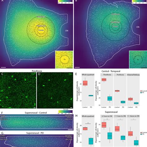 Aii Amacrine Cells Lost Mitochondria In Their Lobular Appendages In Download Scientific Diagram