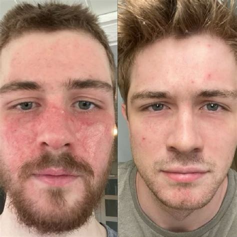 Chris 21 — Lion Diet Success Story