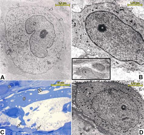 A Em Of A Decidual Rounded Evt N Nucleus N Nucleolus Arrowhead Download Scientific