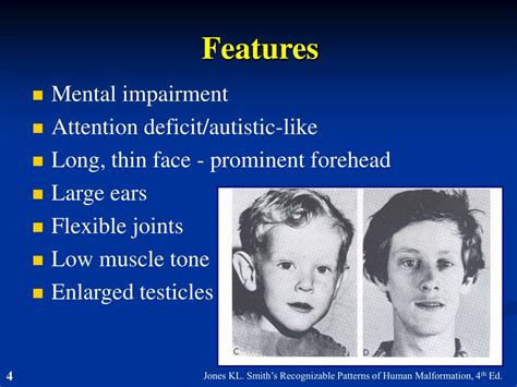 PPT Fragile X Laboratory Testing Background And Quality Improvement