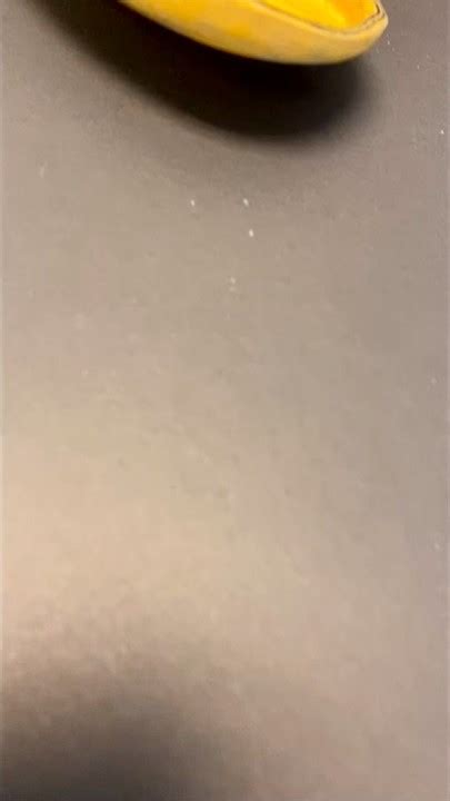 Connor Pardy On Linkedin Footsurgery Prosthetics